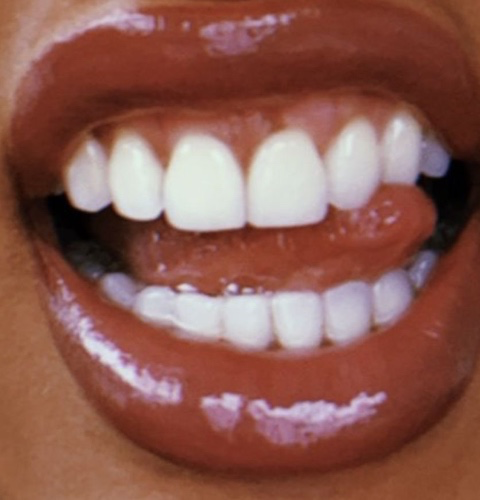 Throne | Sade West | Teeth Whitening Procedure
